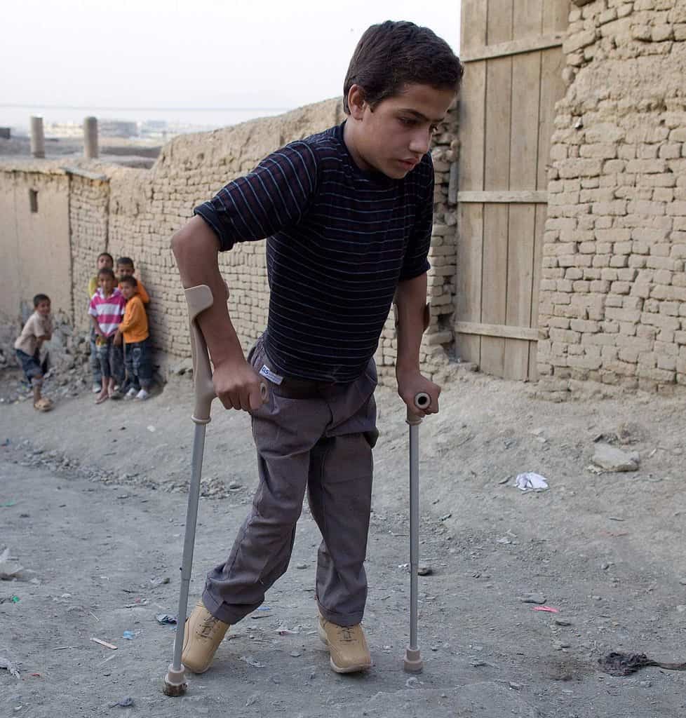 فلج اطفال (پولیو) و نگاهی به علائم ابتلا، تشخیص، پیشگیری و درمان این بیماری